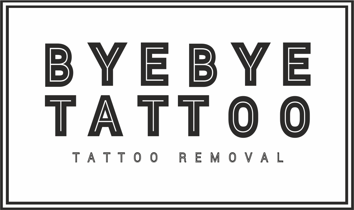 Bye Bye Tattoo | ByeBye Tattoo